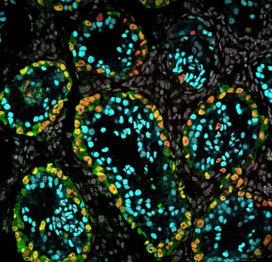 iPSC protocol opens the door to explore male infertility treatments ...